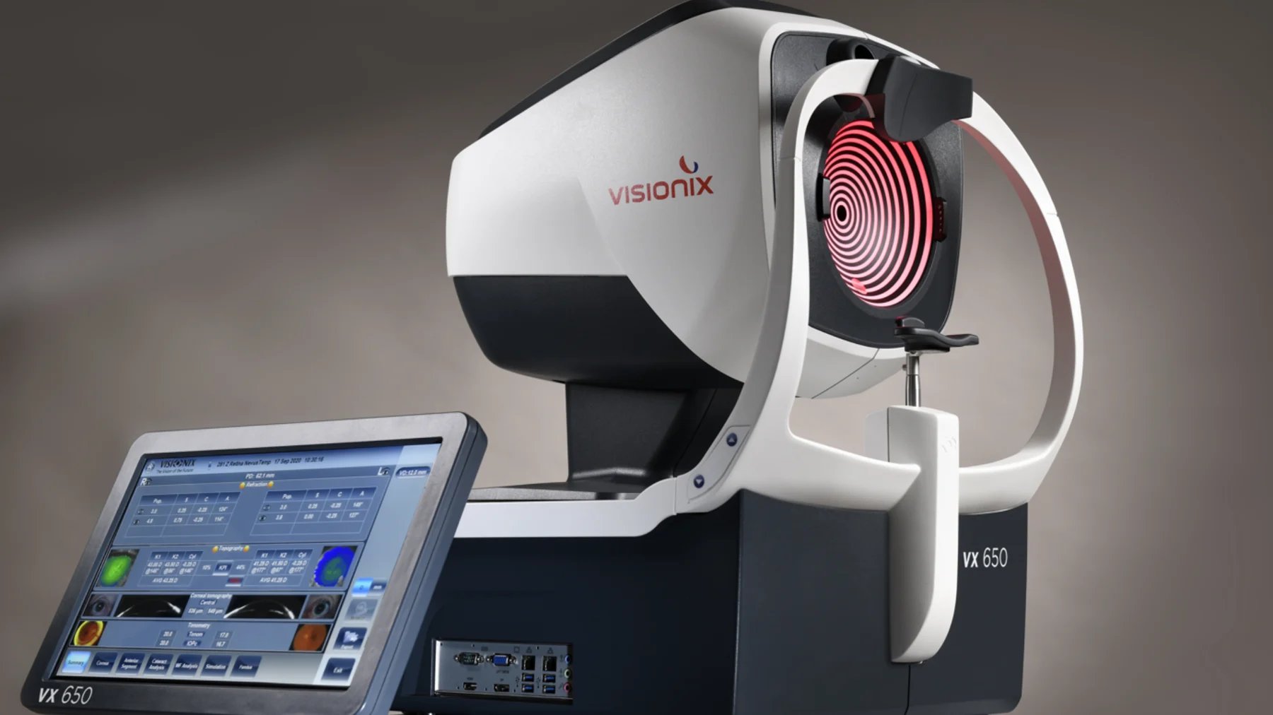 [Visionix VX650]: An innovative tool for screening ocular pathologies